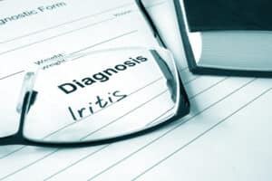 What is Iritis and How is it Treated? - Portland, OR - Eye Clinic P.C.