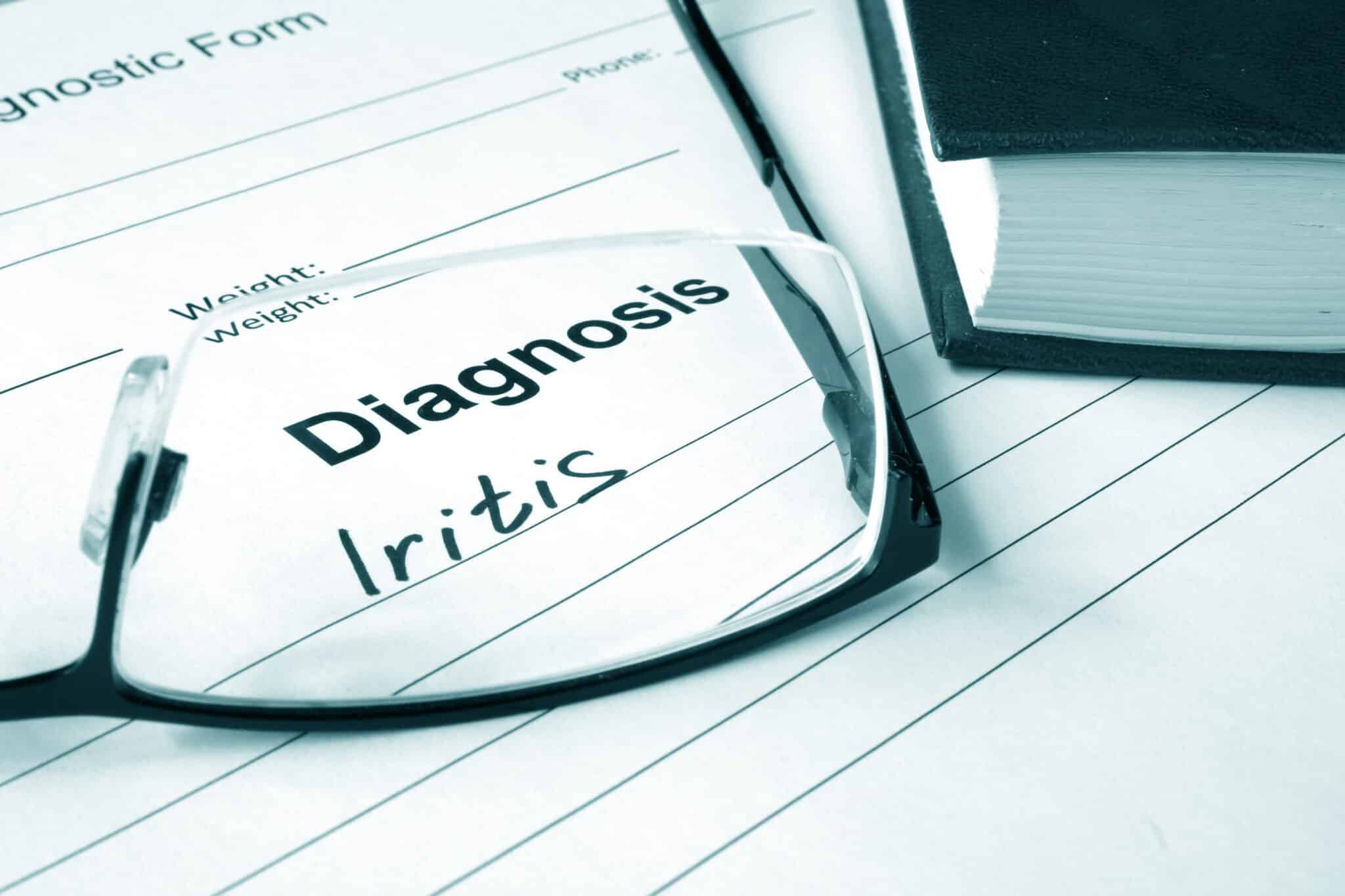 What is Iritis and How is it Treated? - Portland, OR - Eye Clinic P.C.